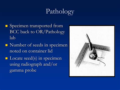 PPT Radioactive Seed Localization PowerPoint Presentation Free Download ID 716864