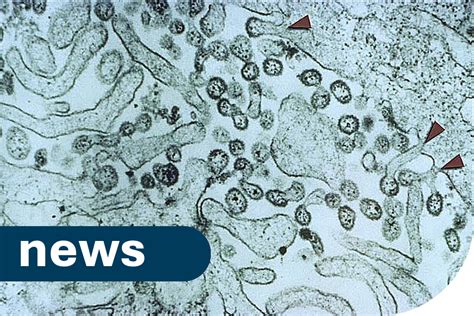 Lassa Fever Contact Tracing Begins Mirage News