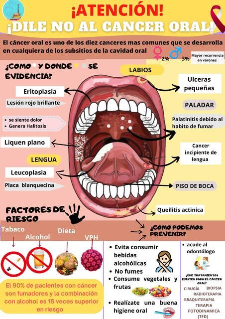 CÁncer Oral PÓster Odontobin By Tatiana Lara Udocz