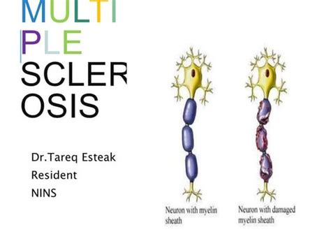 Multiple Sclerosis Diagnosispresentation Pptx