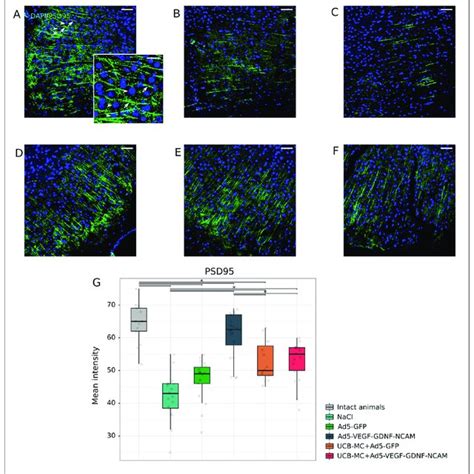 Immunoexpression Of Psd95 In The Rat Brain Cortex 21 Days After The