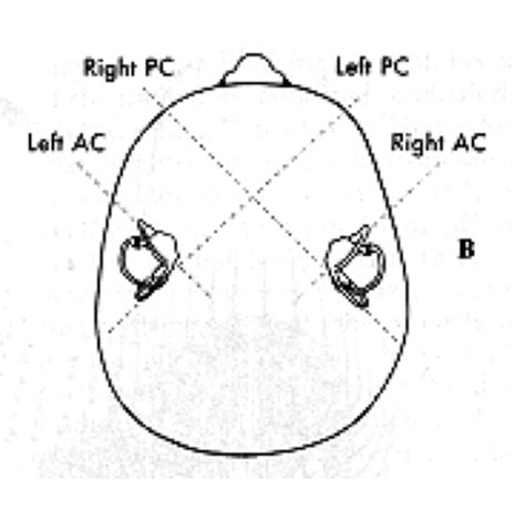 Ortho Patho Neuro Patho New Material For Final Exam Flashcards Quizlet