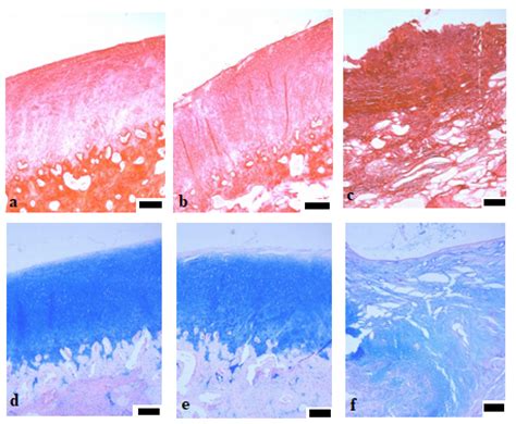 Ijms Free Full Text Tetracalcium Phosphate Biocement Hardened With