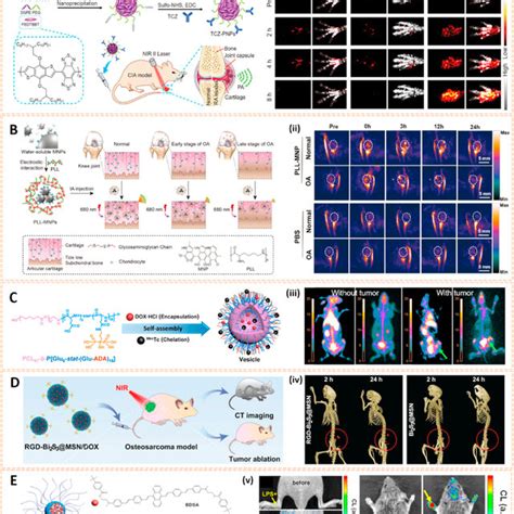 Nanomaterials Based Scaffolds For Cartilage Regeneration A Schematic Download Scientific