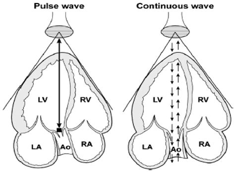 Schematic Representation Of Pulse Wave And Continuous Wave Doppler At Download Scientific