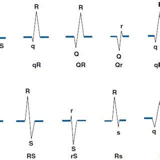 The QRS Complex Morphology Adopted From Download Scientific Diagram