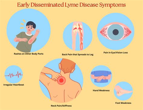 Lyme Disease Grace Health Centre