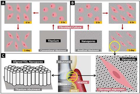 New Nanopore Dental Implant Enhances Tissue Integration