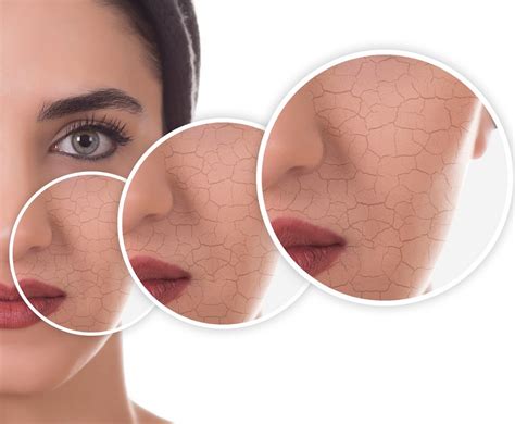 تفاوت پوست خشک و دهیدراته چیست؟ بررسی کامل هر دو پوست مقالات مرتبط