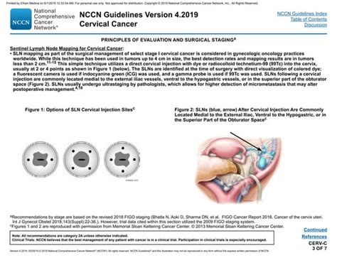 Cáncer Cérvicouterino Guia Nccn 2019 Pdf Cancer Diseases And Conditions