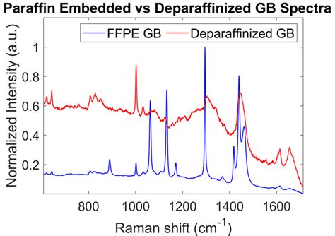 1 Paraffin Embedded Vs Deparaffinized Glioblastoma Gb Tissue Download Scientific Diagram