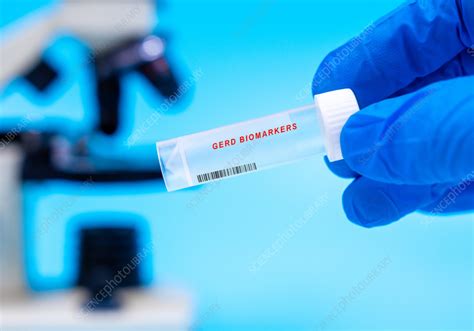 Gastroesophageal Reflux Disease Saliva Test Stock Image F0449086