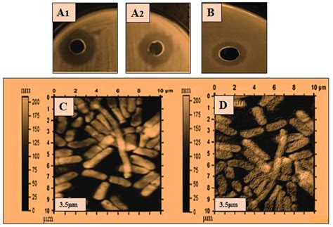 Antibacterial Activity Of Lysozyme Zone Of Inhibition Zoi A B Zoi Download Scientific