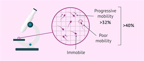 What Values Are Normal In Sperm Motility Analysis