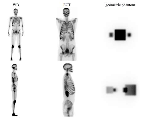 Low Dose Sinogram Restoration Enabled By Conditional Gan With Cross Domain Regularization In