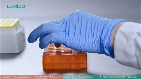 Sperm Dna Fragmentation Detection Kit Sperm Chromatin Dispersion Method Version Before May