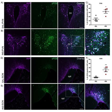 Avp Magnocellular Neurons Are Activated By Insulin Induced Hypoglycemia Download Scientific