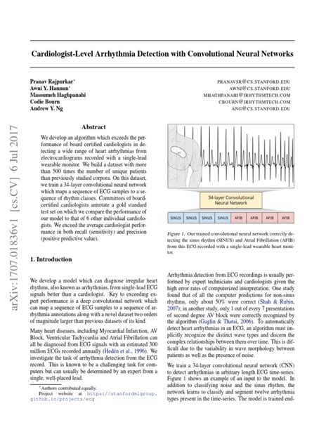 Cardiologist Level Arrhythmia Detection With Convolutional Neural