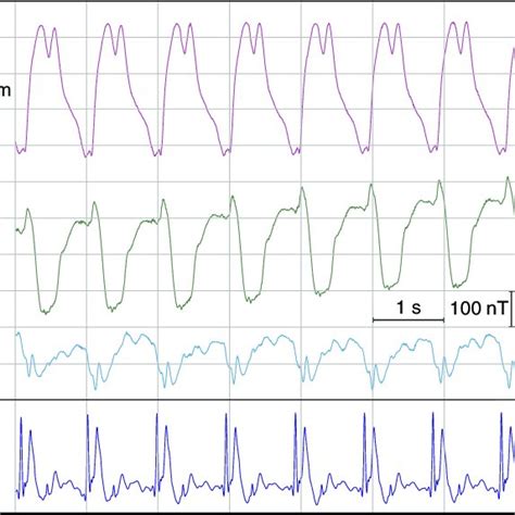 Real Time Magnetic Field Recordings Of Cardiac Activity Magnetic Download Scientific Diagram