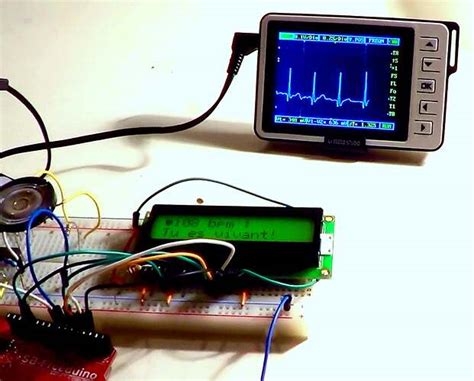 Difference Between LCD Standard And LCD I C Displays Arduino Forum