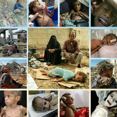 The Saudi Led Coalition Has Been Using Starvation As A Weapon To