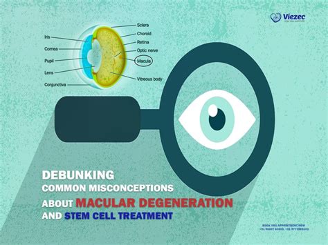 Misconceptions About Macular Degeneration And Stem Cell Treatment