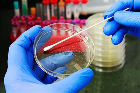 Cultivo De Bacterias Laboratorios González
