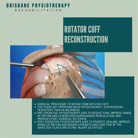 Rotator Cuff Pain Issues Treatment Reconstruction And Tendinopathy