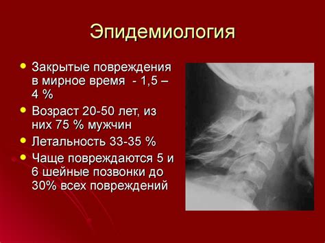 Травма позвоночника и спинного мозга презентация онлайн