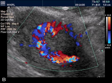 Pin On OB Gyn Ultrasound 101 Mod 2