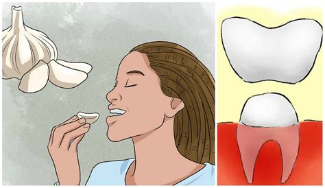 მოირჩინეთ მხოლოდ ნივრით ღრძილების ანთება და მოიშორეთ უსიამოვნო სუნი პირიდან სასარგებლო რჩევები