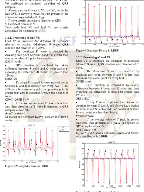 Figure 3 From Cardiac Arrhythmia Detection By Ecg Feature Extraction Semantic Scholar