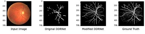 GitHub Aghdamamir DDRNet SemanticSegmentation A Pytorch