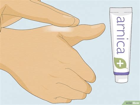 How To Wrap A Sprained Thumb Easy Step By Step Guide