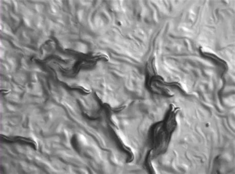 Video Chemotaxis Assay In Caenorhabditis Elegans