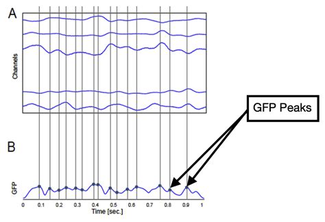 Github T5pathakdemystifyingeegmicrostates Understanding And Implementing Eeg Microstate