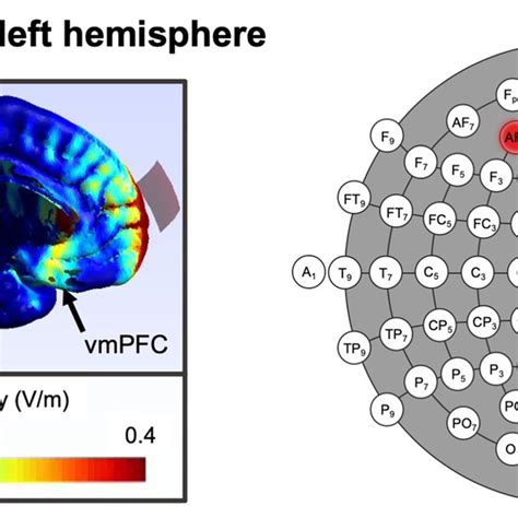 Biophysical Modeling Of The Currents Distribution And Magnitude Download Scientific Diagram