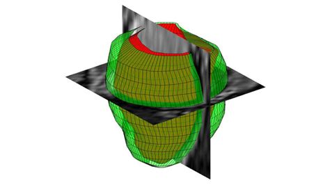 DICOM MATLAB Simulink