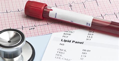 The Most Important Lipid Panel Marker Pd Mangan