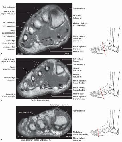 Foot Ankle And Calf Musculoskeletal Key
