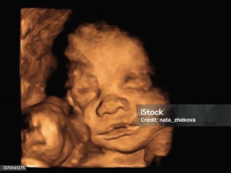어머니의 자궁에 있는 아기의 화상 초음파 3d4d 3차원 초음파에 대한 스톡 사진 및 기타 이미지 3차원 초음파