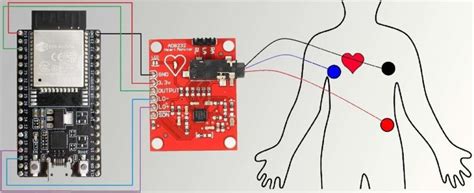 Iot Ecg Monitoring With Ad8232 Ecg Sensor And Esp8266