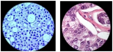 Classification — Breast Cancer Diagnostic By Abdul Kadir Syahab Medium