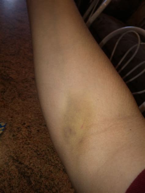 Нерадивые врачи Профосмотр — Drive2