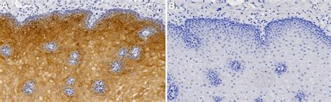 Thioredoxin Sigma Aldrich