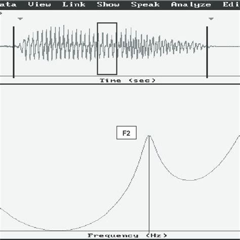 Example Of A Typical Display Used For Measurement Of Vowel Duration And Download Scientific
