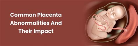 Understanding Placenta Abnormalities Impact And Types