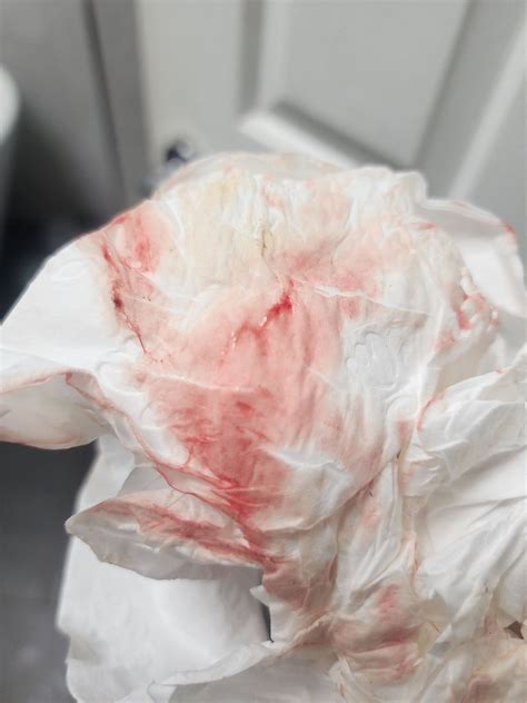 Implantation Bleeding Babycenter