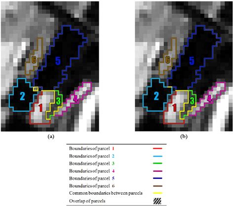 Figure 15 From Delineation Of Agricultural Field Boundaries Using Random Sets Semantic Scholar