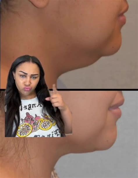 Beauty Fan Shares Trick To Get Rid Of Double Chin In Seconds And You Don T Even Have To Leave